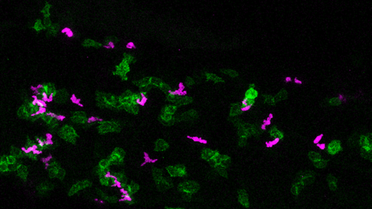 Gene mutation reprograms cells and tricks immune cells to promote ...