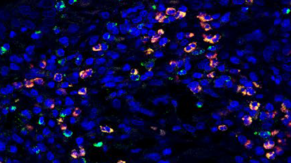 New optical reporting tool for finding IBD in patient samples ...