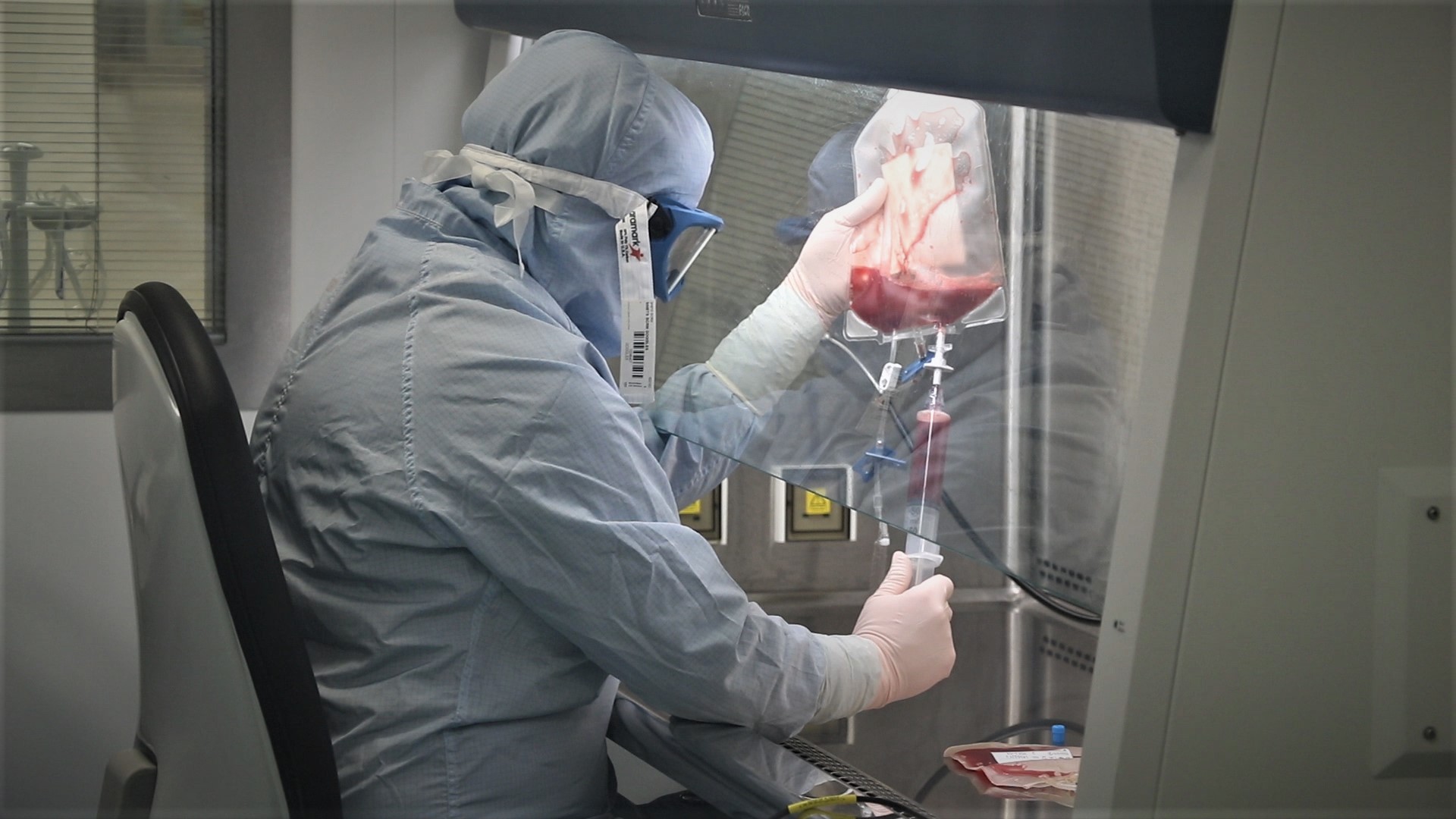 New cell therapy shows progress in treating advanced liver disease ...