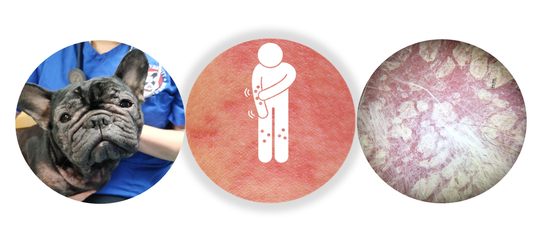 Inflammation | Edinburgh Skin Network | Institute for Regeneration and ...