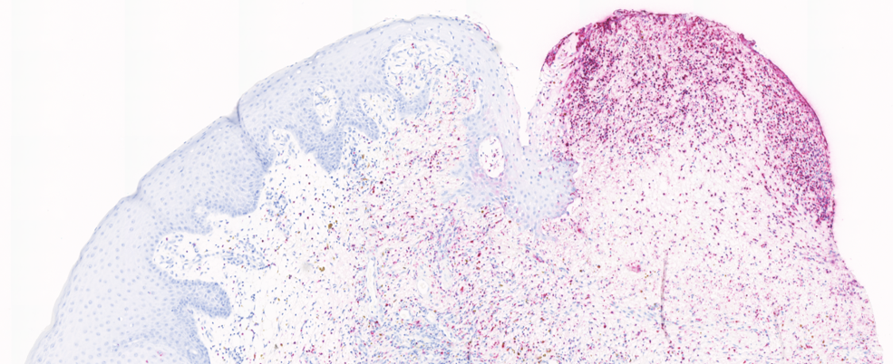 Wounds | Edinburgh Skin Network | Institute for Regeneration and Repair